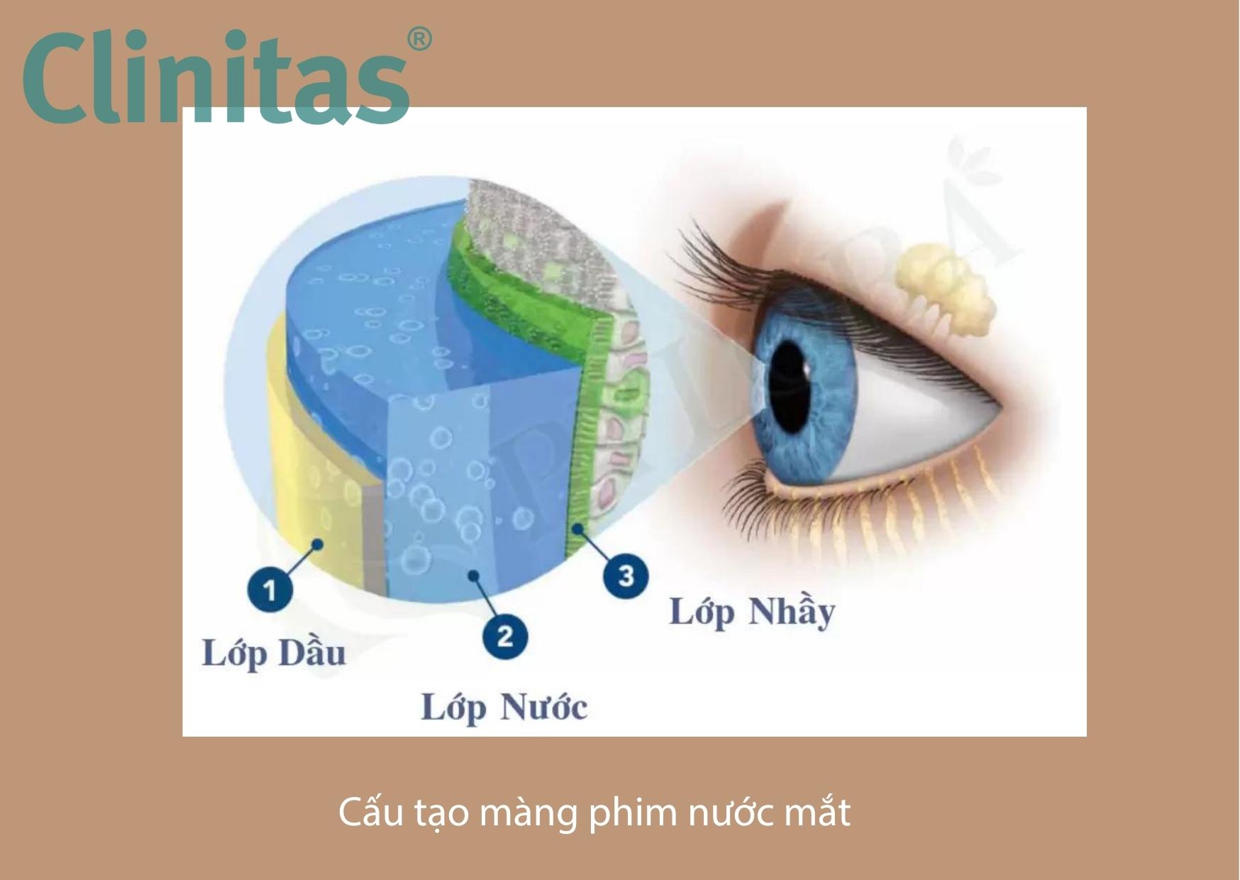 6 Điều cần biết về Khô mắt, Mỏi mắt bạn không nên bỏ qua - Clinitas ...